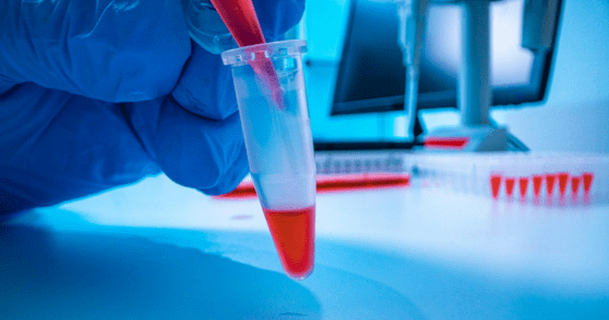 Sample Storage | Preserving Biological Specimen